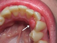 Fotogalerij. :: info-over-kanker.nl